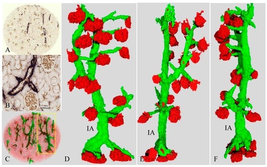 Age-Related Renal Microvascular Changes: Evaluation by Three ...