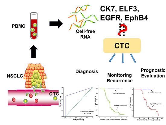 IJMS | Free Full-Text | Cell-Free RNA Content in Peripheral Blood as Potential Biomarkers for ...