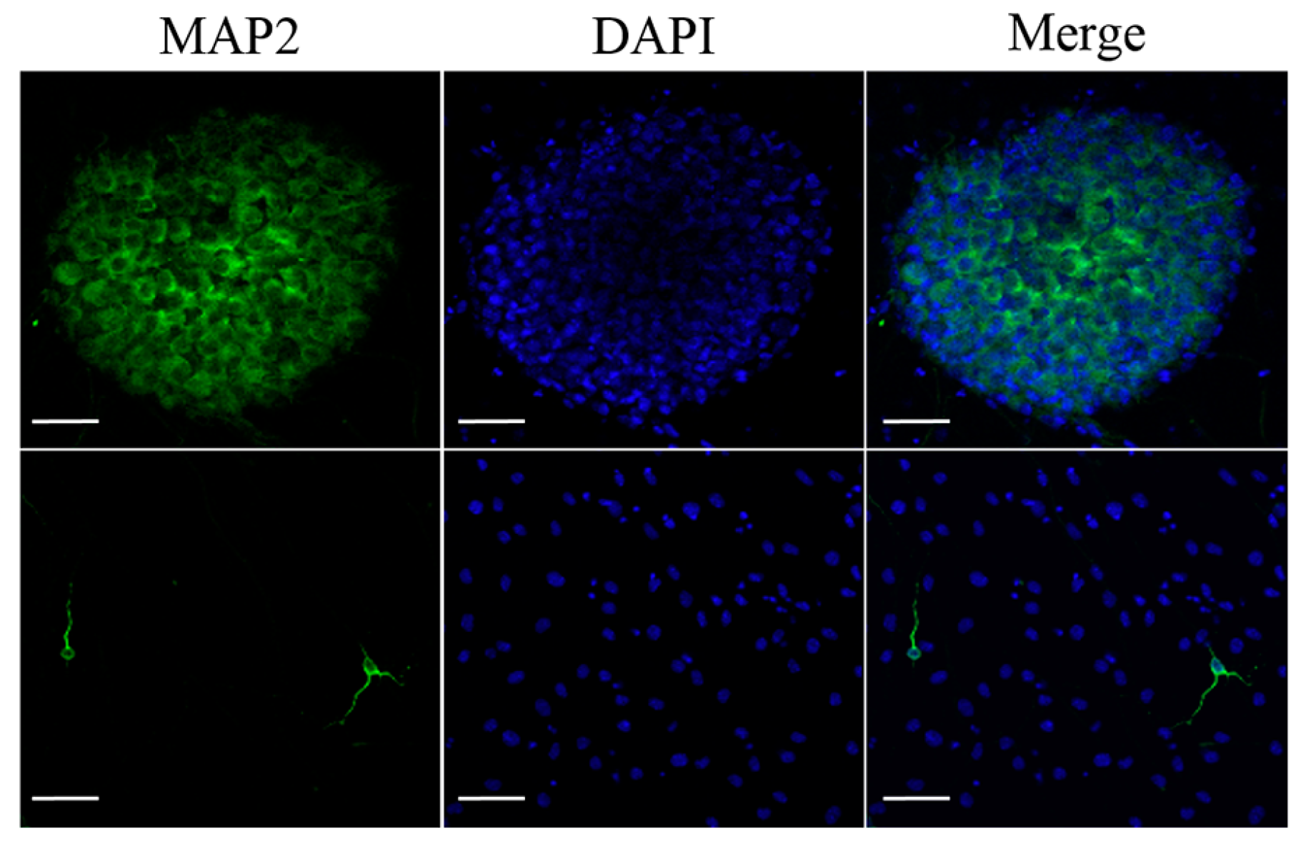 Tonsil-Derived Mesenchymal Stem Cells Differentiate into a Schwann Cell ...