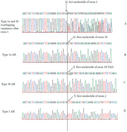 IJMS | Free Full-Text | Novel Nine-Exon AR Transcripts (Exon 1/Exon 1b ...