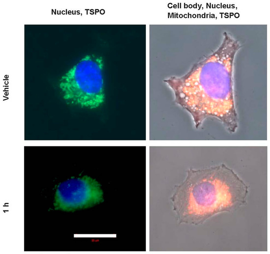 Classical and Novel TSPO Ligands for the Mitochondrial TSPO Can ...