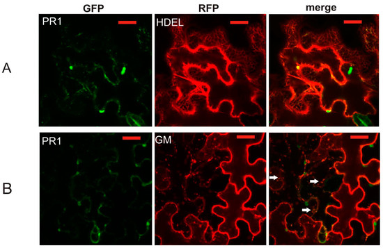 Subcellular Localization of Arabidopsis Pathogenesis-Related 1 (PR1 ...