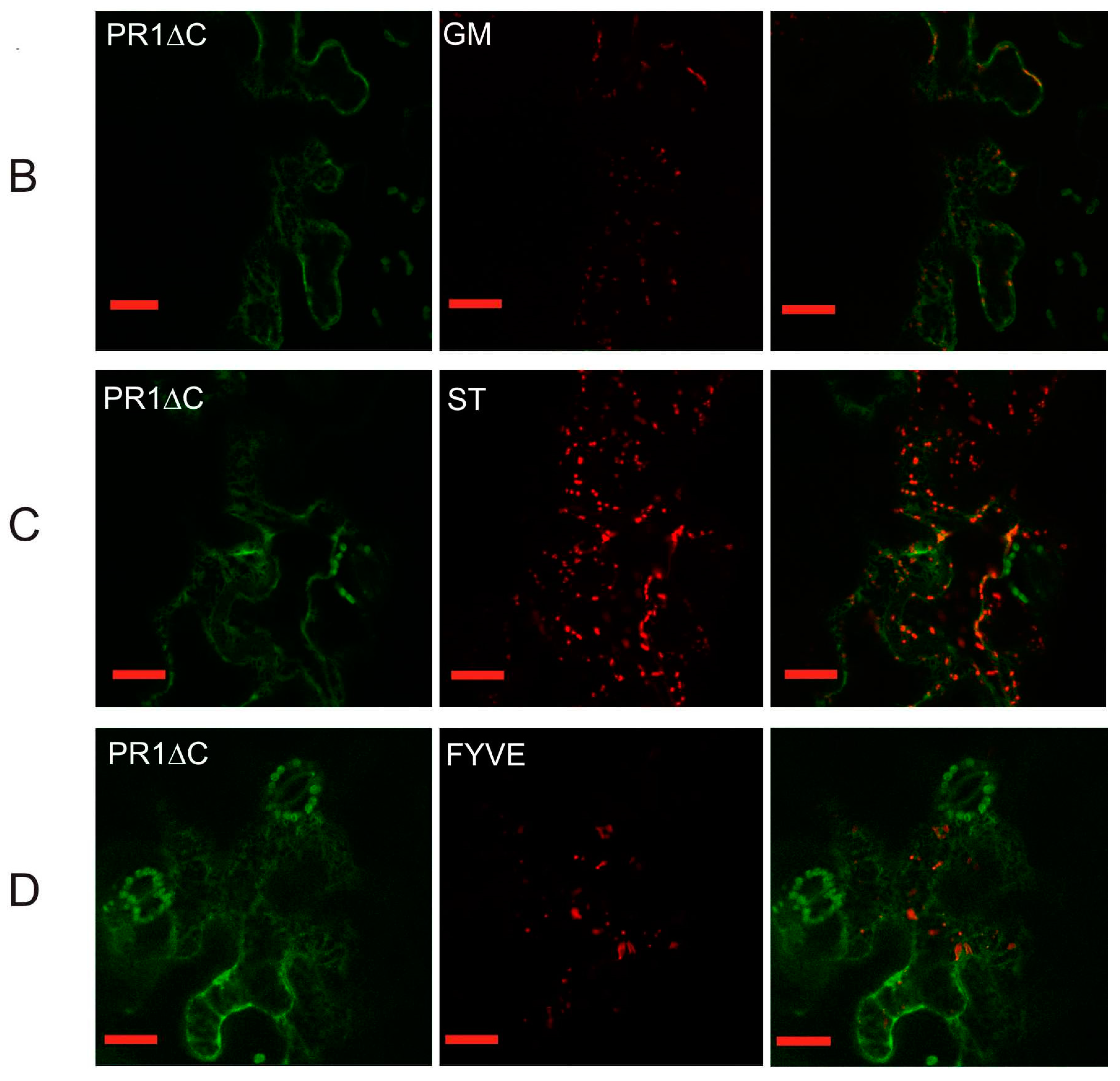 Subcellular Localization of Arabidopsis Pathogenesis-Related 1 (PR1 ... Subcellular Localization of Arabidopsis Pathogenesis-Related 1 (PR1 ...