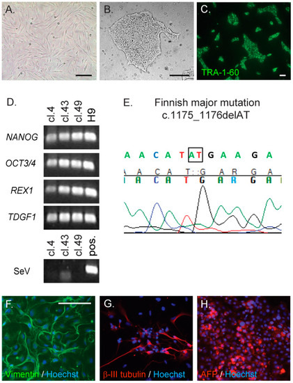Induced Pluripotent Stem Cells Derived from a CLN5 Patient Manifest ...