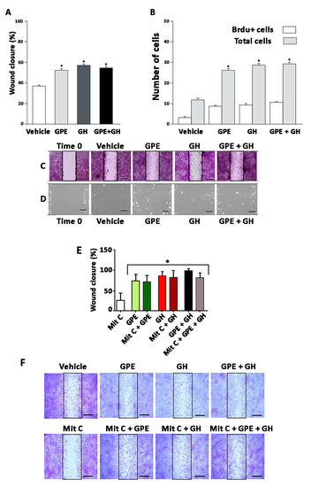 GPE Promotes the Proliferation and Migration of Mouse Embryonic Neural ...