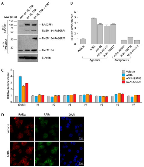 A Case of AML Characterized by a Novel t(4;15)(q31;q22) Translocation ...