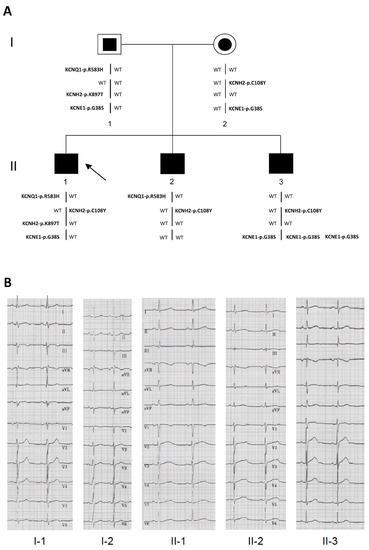 IJMS | Free Full-Text | Allelic Complexity in Long QT Syndrome: A ...