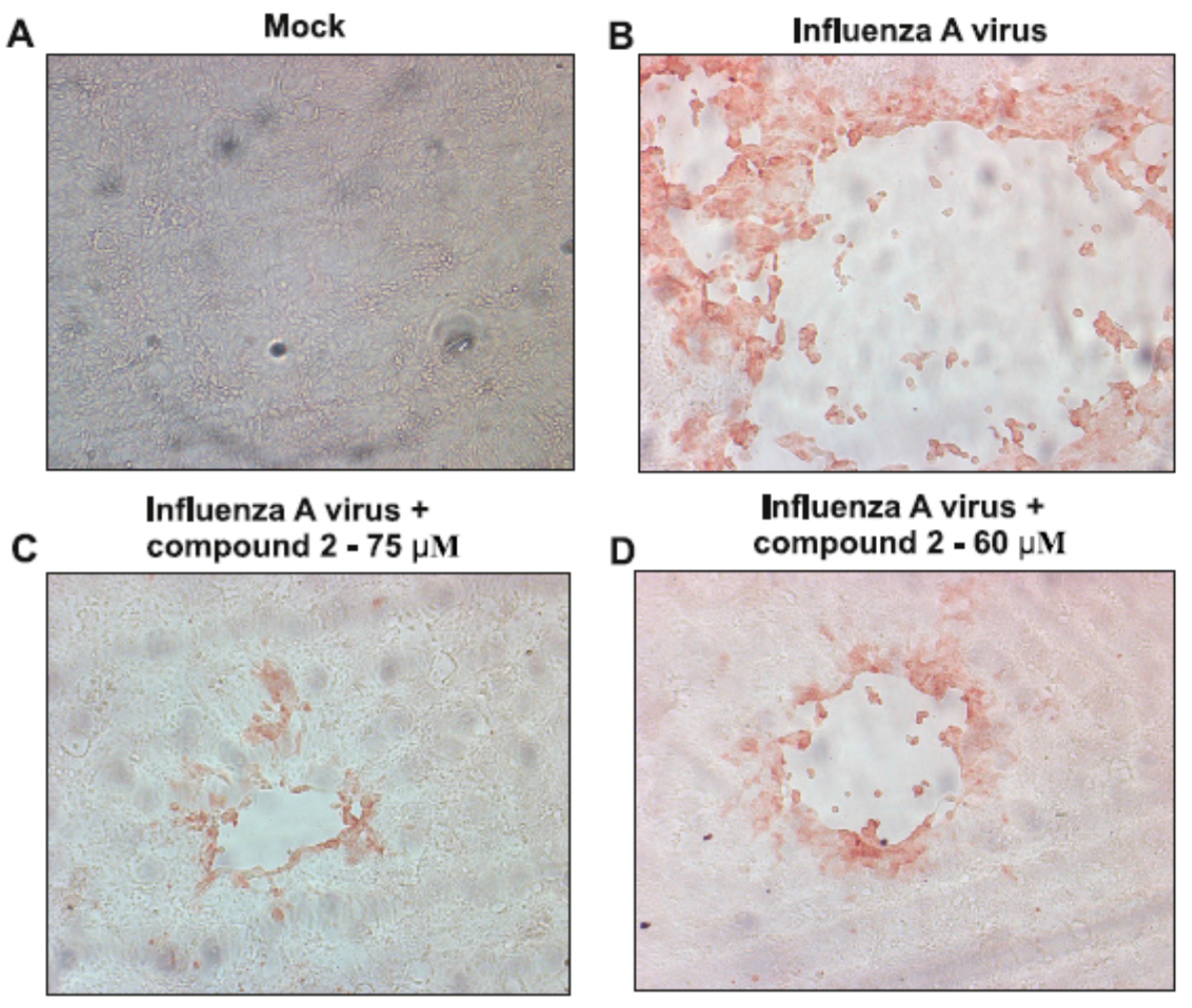 Biological Evaluation of Uridine Derivatives of 2-Deoxy Sugars as ...