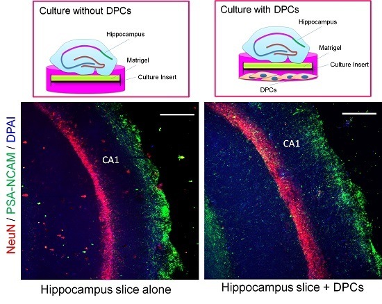 IJMS | Free Full-Text | Human Dental Pulp Cells Differentiate toward ...
