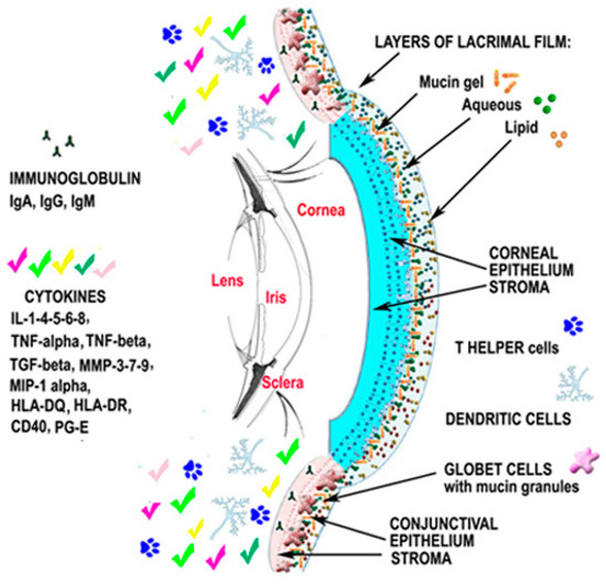 Analysis of the Pathogenic Factors and Management of Dry Eye in Ocular ...