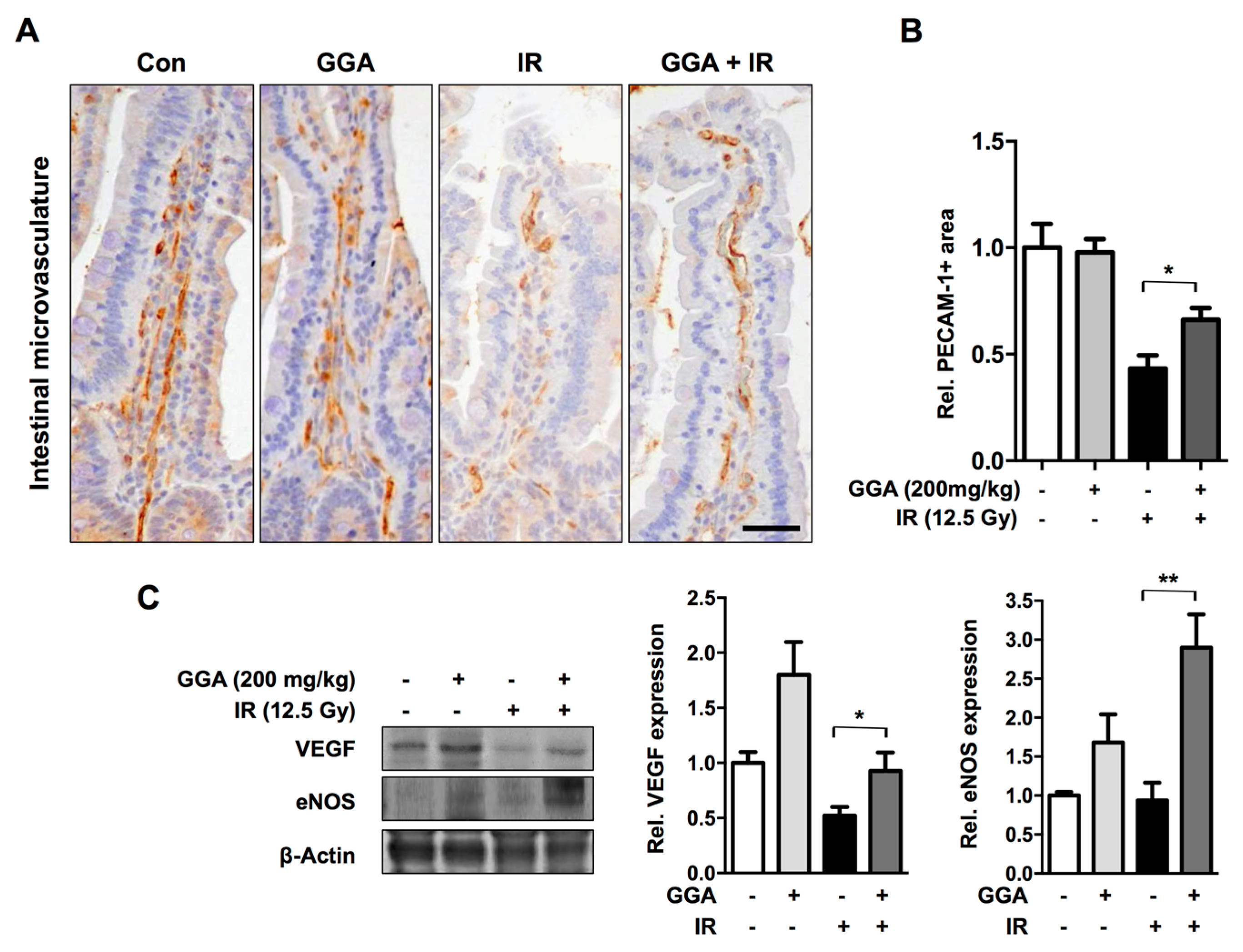 Geranylgeranylacetone Ameliorates Intestinal Radiation Toxicity by ...
