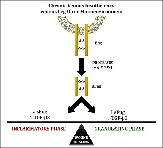 IJMS | Free Full-Text | Chronic Venous Insufficiency: Transforming Growth Factor-β Isoforms and ...