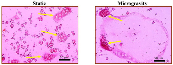 Combined Effects of Simulated Microgravity and Radiation Exposure on ...