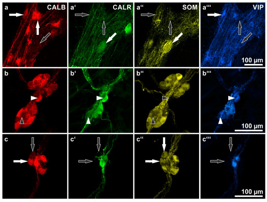 Calbindin D28k-Immunoreactivity in Human Enteric Neurons