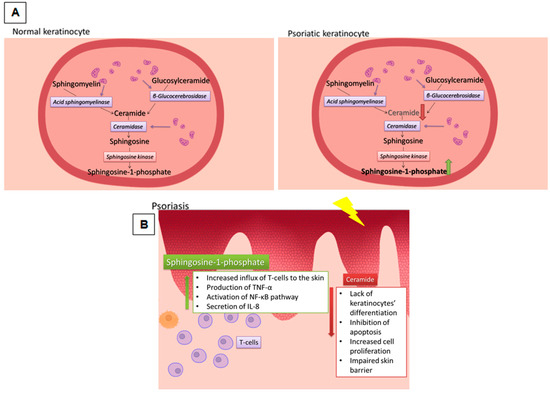 IJMS | Free Full-Text | Abnormal Sphingolipid World in Inflammation ...