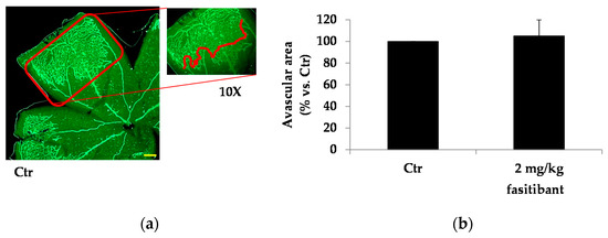 Involvement of Bradykinin B2 Receptor in Pathological Vascularization ...