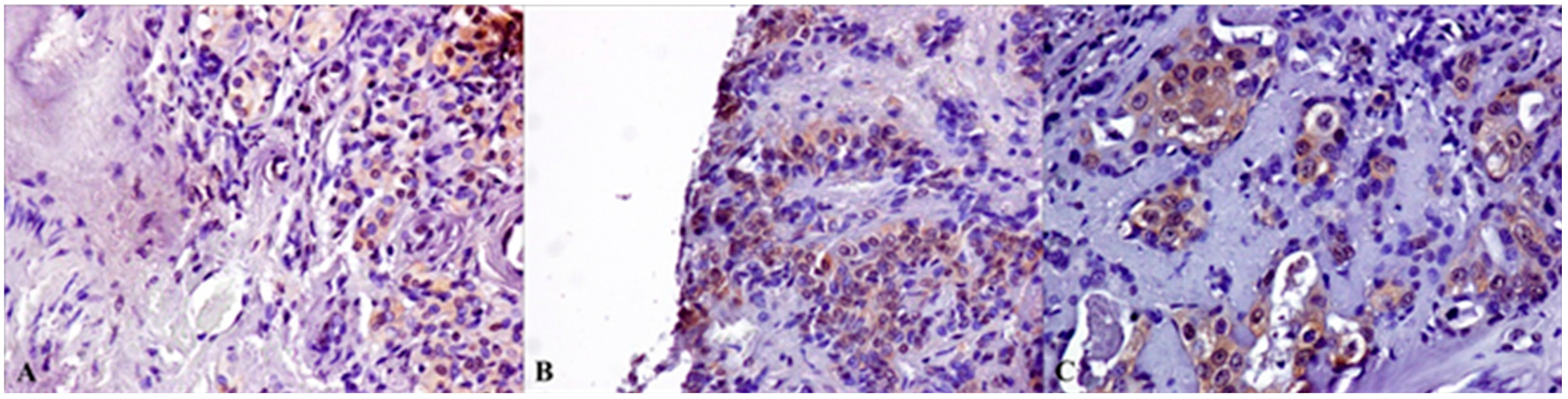 Ijms Free Full Text Sex Hormone Receptors In Benign And Malignant