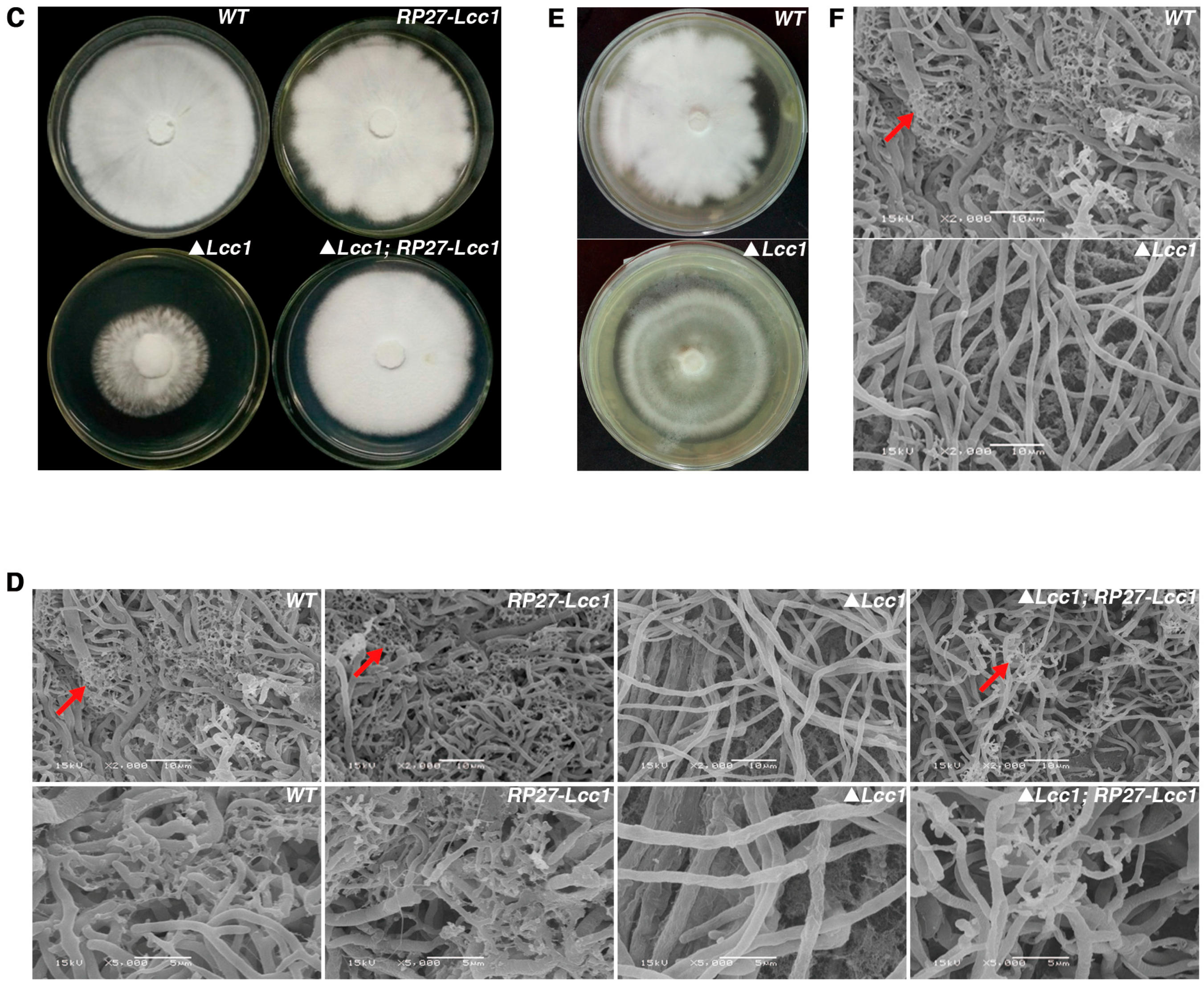 Importance of a Laccase Gene (Lcc1) in the Development of Ganoderma tsugae