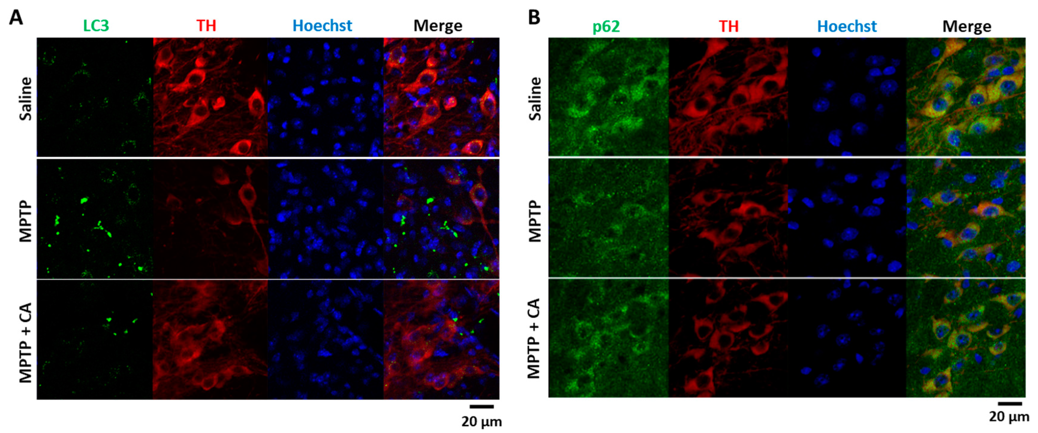 The Neuroprotective Effects of Cinnamic Aldehyde in an MPTP Mouse Model ...