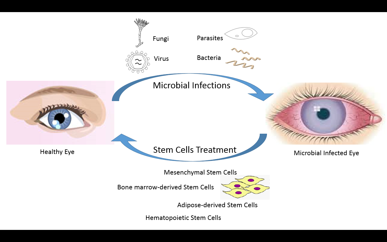 IJMS | Free Full-Text | Recent Updates on Treatment of Ocular Microbial ...