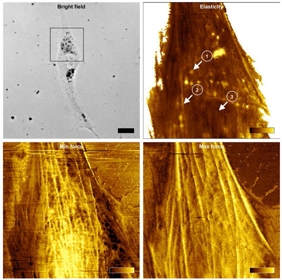 Nanomechanical Phenotype of Melanoma Cells Depends Solely on the Amount ...
