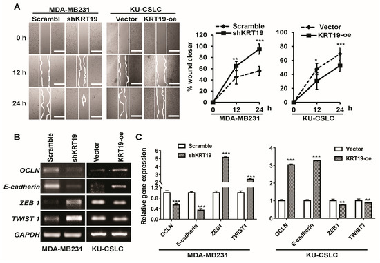 Cytokeratin 19 (KRT19) has a Role in the Reprogramming of Cancer Stem ...