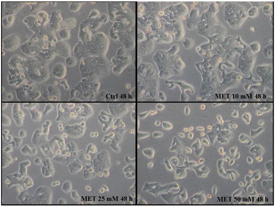 Metformin Induces Apoptosis and Alters Cellular Responses to Oxidative Stress in Ht29 Colon ...