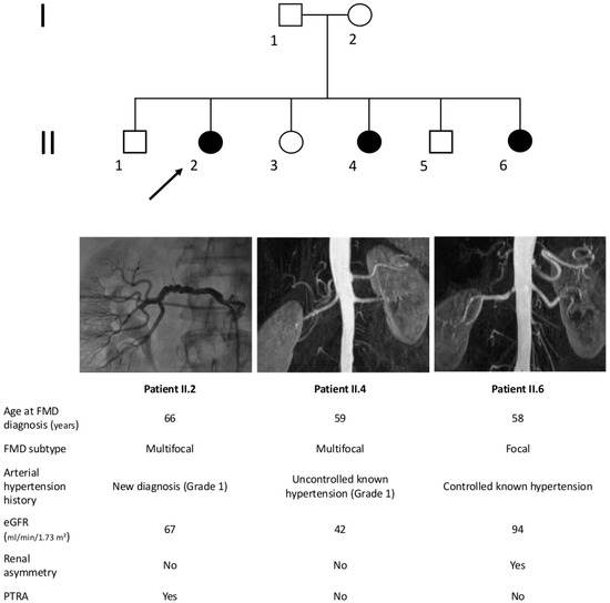 Genomics of Fibromuscular Dysplasia