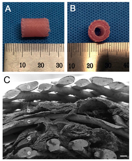 3D Bioprinted Artificial Trachea with Epithelial Cells and Chondrogenic ...