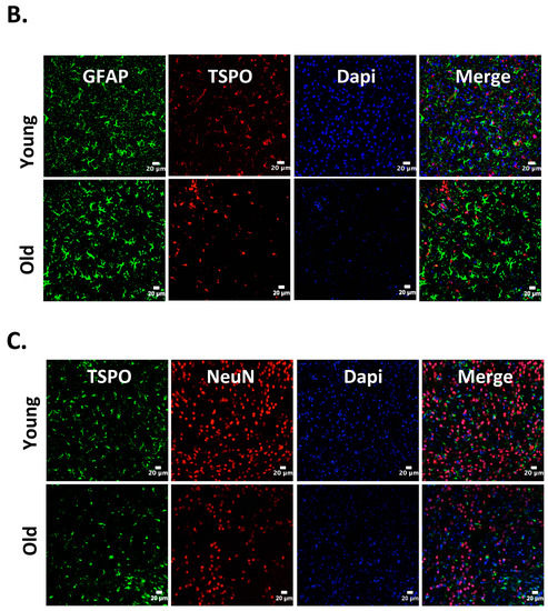TSPO: An Evolutionarily Conserved Protein with Elusive Functions