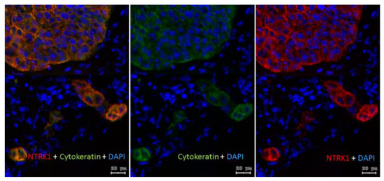 IJMS | Free Full-Text | Nerve Growth Factor (NGF)—Receptor Survival ...