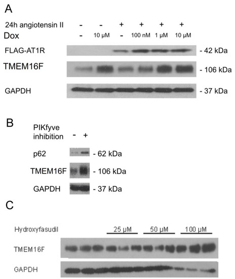 Regulation and Function of TMEM16F in Renal Podocytes