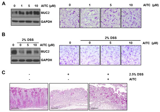Allyl Isothiocyanate Ameliorates Dextran Sodium Sulfate-Induced Colitis ...