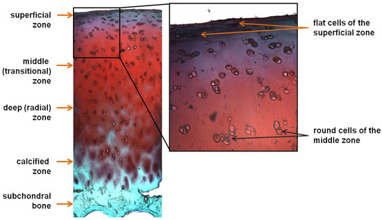 Repair of Damaged Articular Cartilage: Current Approaches and Future ...
