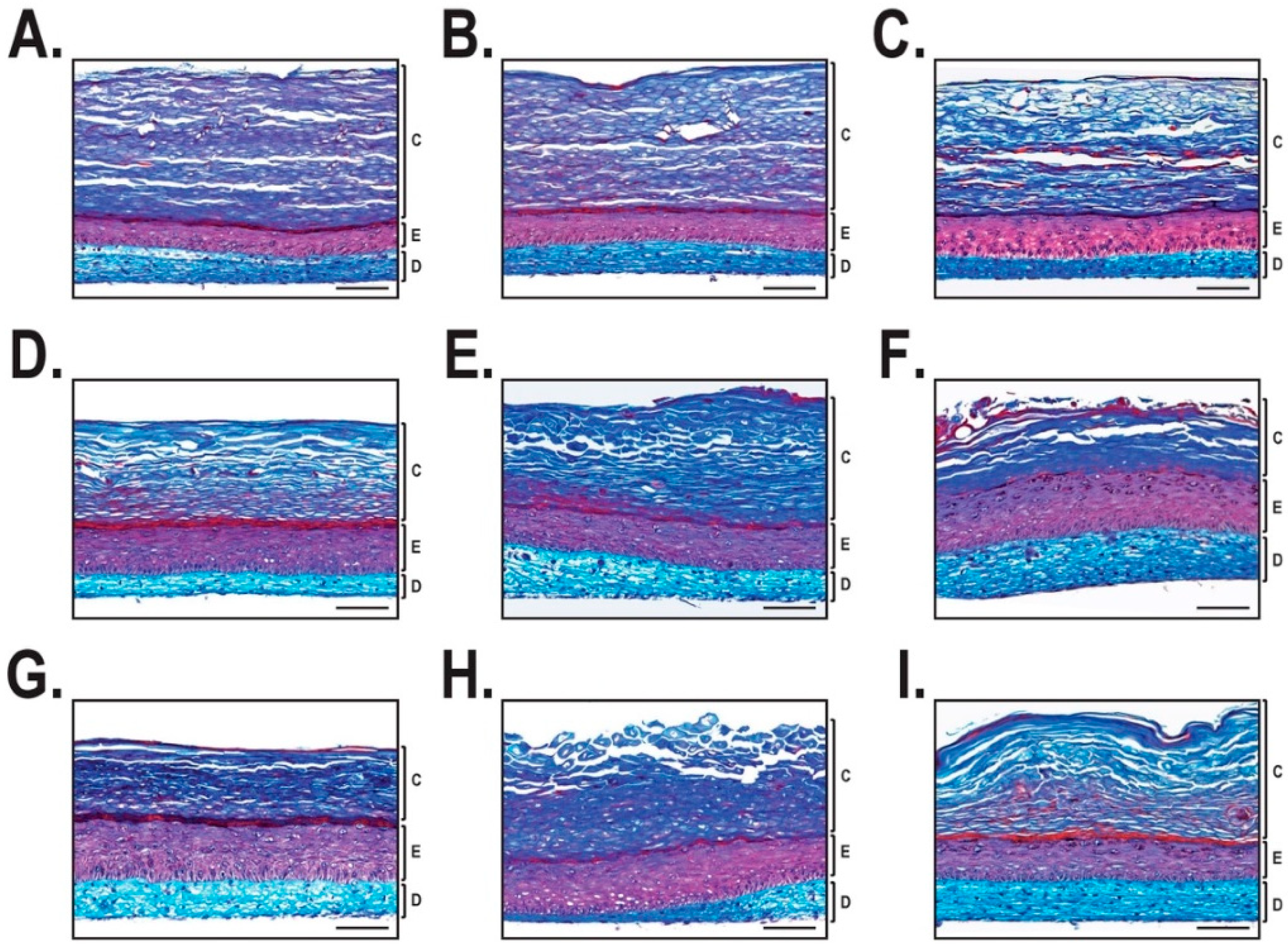 IJMS | Free Full-Text | The Tissue-Engineered Human Psoriatic Skin ...
