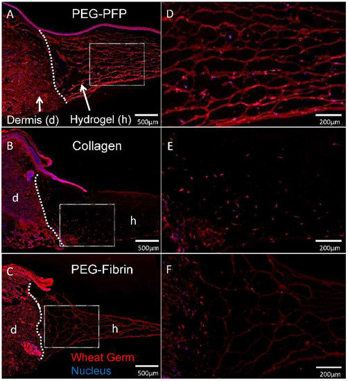 PEG-Plasma Hydrogels Increase Epithelialization Using a Human Ex Vivo ...
