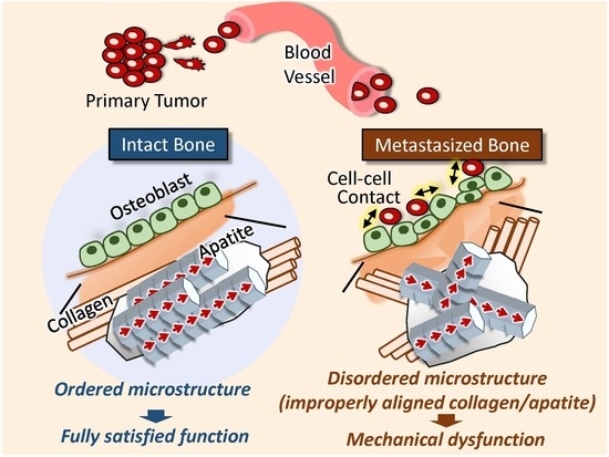 IJMS | Special Issue : Bone Metastasis: Pathophysiology and Molecular ...