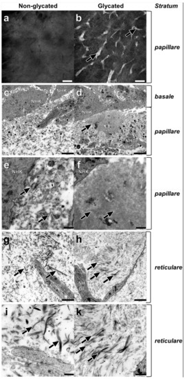 Ultrastructural and Molecular Analysis of Ribose-Induced Glycated ...