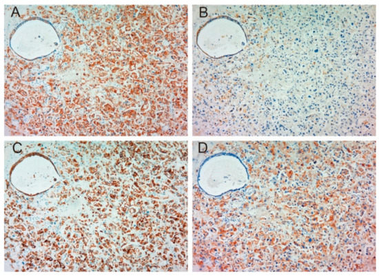 Matriptase-Induced Phosphorylation of MET is Significantly Associated ...
