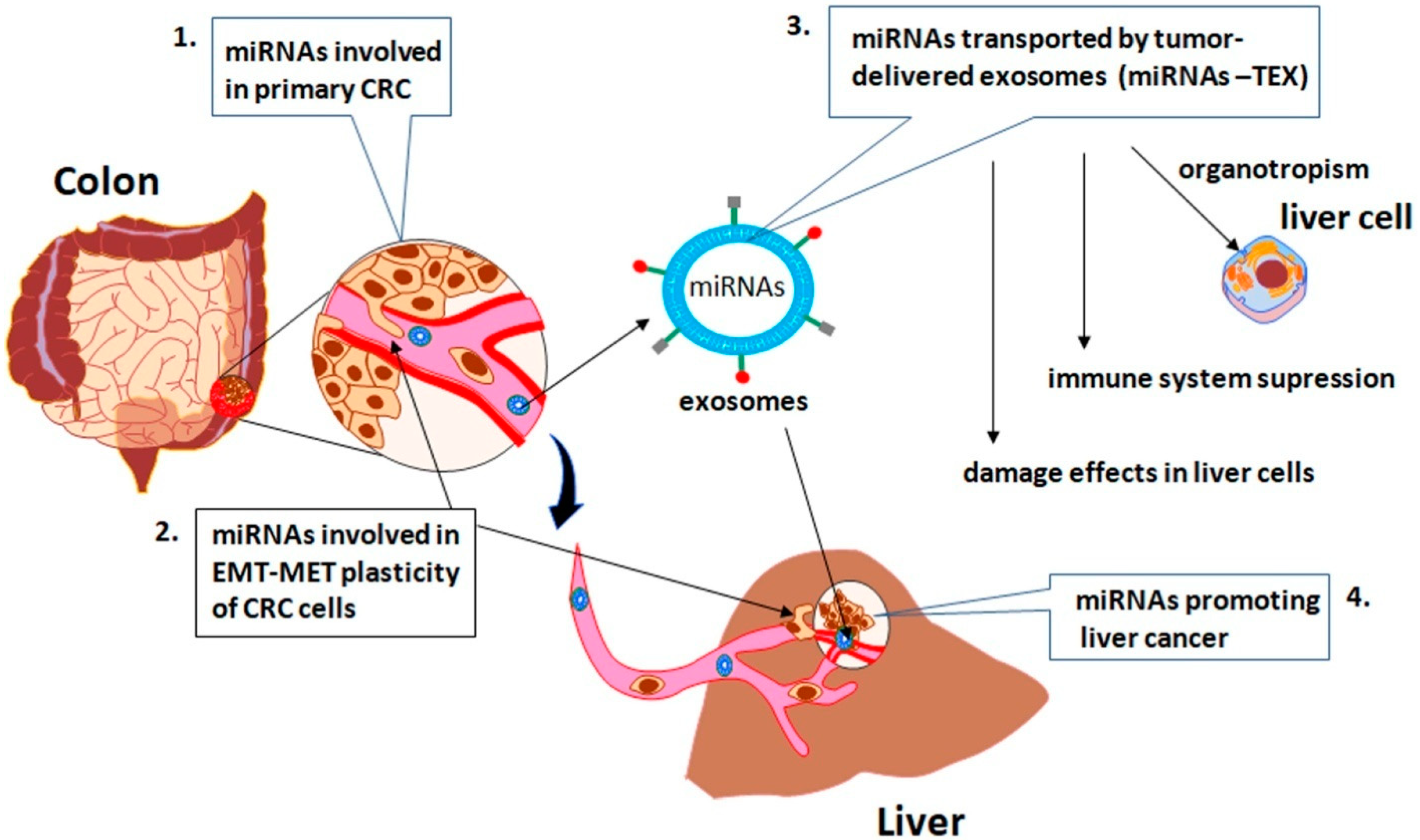 Colorectal Cancer Progression