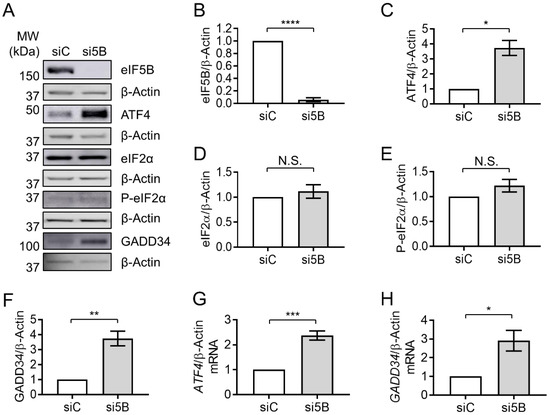 IJMS | Free Full-Text | Eukaryotic Initiation Factor 5B (eIF5B ...