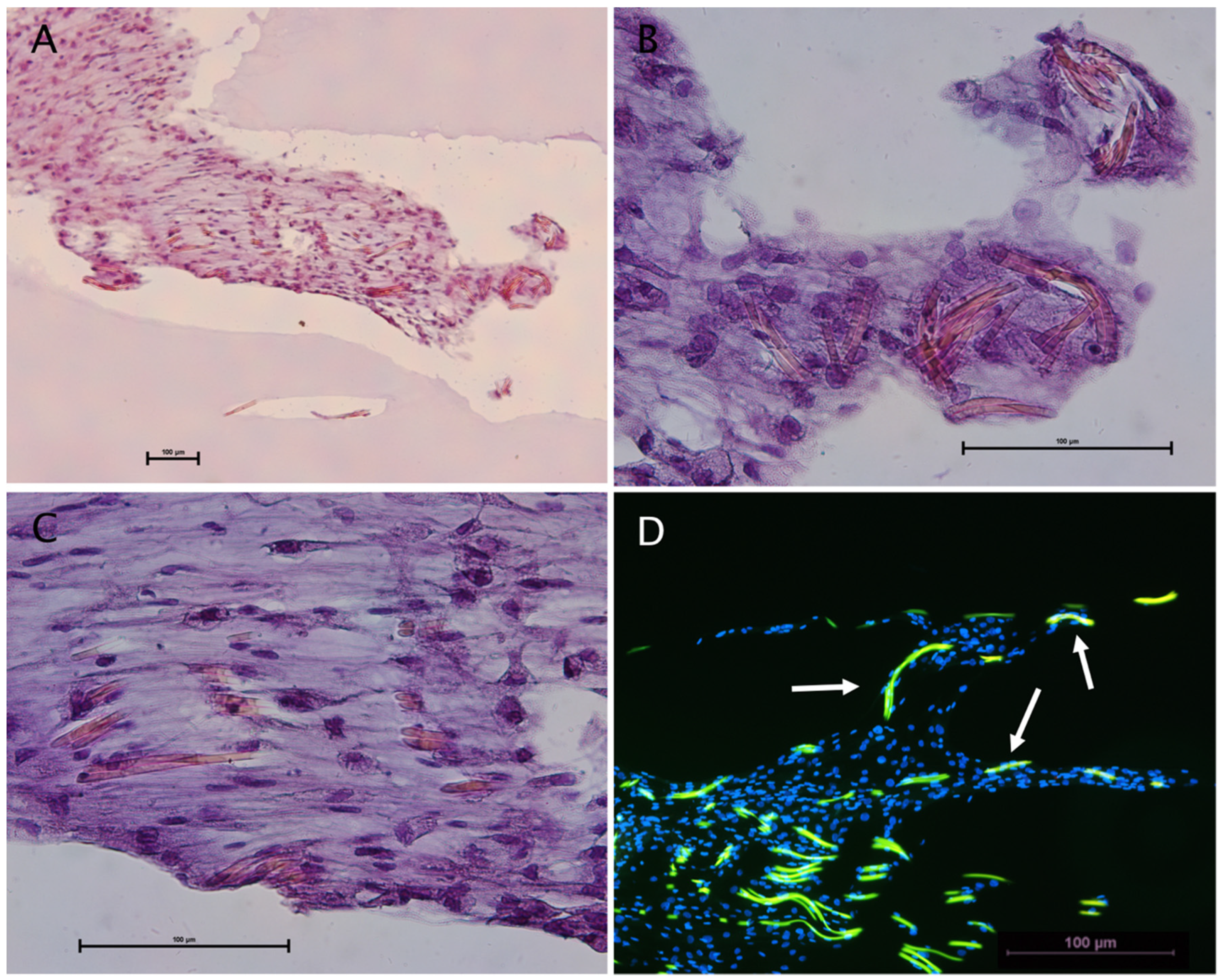 Co-Culturing Human Adipose Derived Stem Cells and Schwann Cells on ...