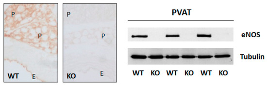 New Therapeutic Implications of Endothelial Nitric Oxide Synthase (eNOS ...