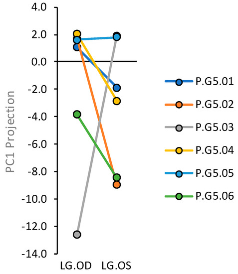 IJMS | Free Full-Text | Molecular Evidence for Precursors of Sjögren’s ...
