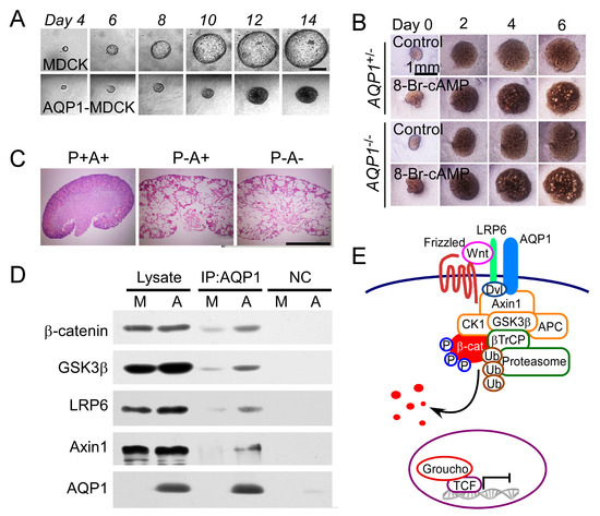 Aquaporins in Renal Diseases