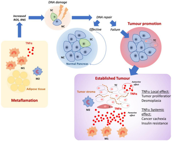 Inflammation and Pancreatic Cancer: Focus on Metabolism, Cytokines, and ...