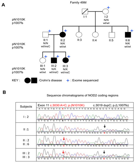 A Novel Rare Missense Variation of the NOD2 Gene: Evidences of ...