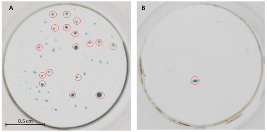 IJMS | Free Full-Text | Development of Autologous Platelet-Rich Plasma ...