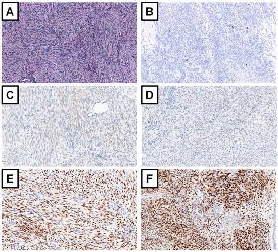 The Usefulness of Immunohistochemistry in the Differential Diagnosis of ...