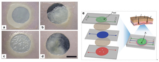 Bioengineered Skin Intended for Skin Disease Modeling
